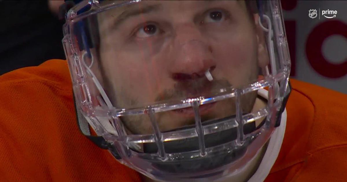 Zach Hyman returns to game after taking a puck to the face